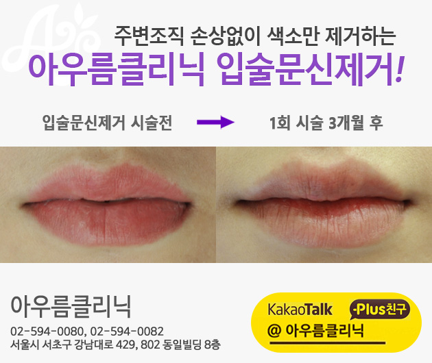 입술색소침착 레이저로 입술색 되돌리기 네이버 블로그