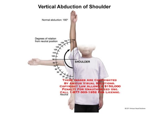 [MT] Medical Trainer Level 1 - Neuromuscular Pattern Test / 1. Shoulder ...