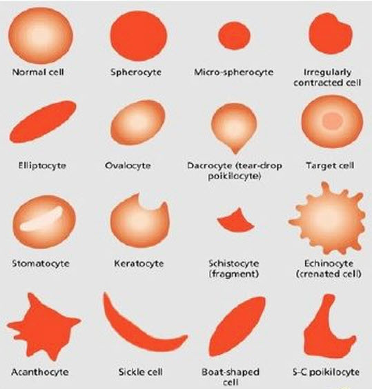 적혈구의 형태,크기,염색성 변화와 봉입체 : 네이버 블로그