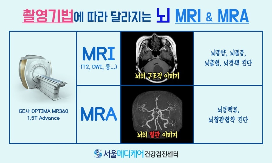 뇌 MRI MRA, 뇌혈관질환(뇌졸중, 뇌출혈, 뇌종양, 뇌동맥류) 검사방법 : 네이버 블로그