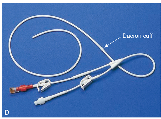중심정맥관(Central Venous Catheter), PICC에 대해서. [종류, 합병증, 관리, 삽입] : 네이버 블로그